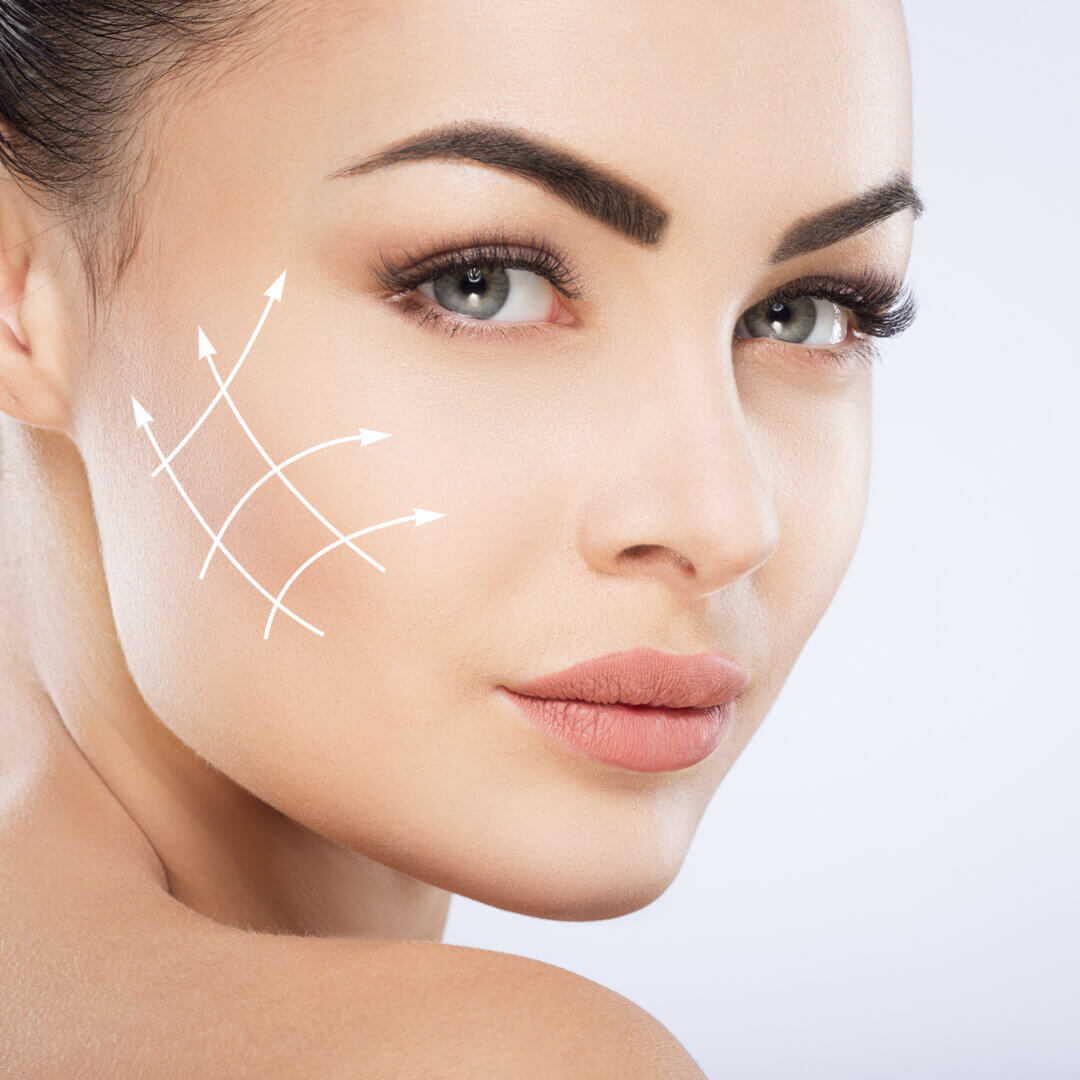 Face Lift with Spider Web Technique - Promar Wellness